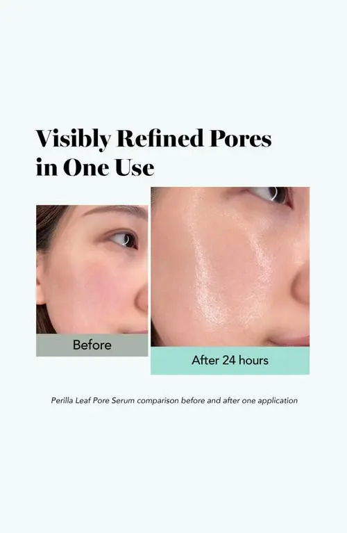 SATURDAY SKIN Perilla Leaf Pore Serum