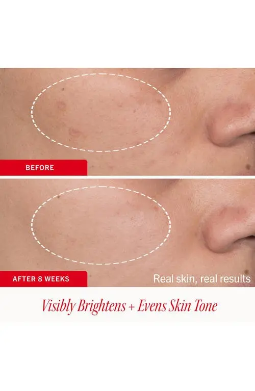 FIRST AID BEAUTY Brighten + Glow Dark Spot Serum
