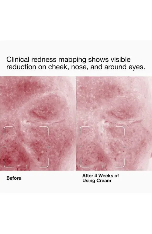 CLINIQUE Daily Calm™ Soothing Repair Cream