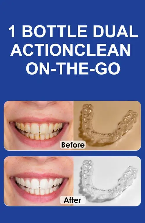 MYSMILE 2-in-1 Aligner Cleaner & Ning Foam