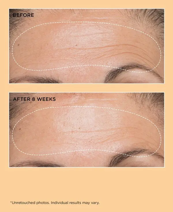 PERRICONE MD Neuropeptide Firming Facial Concentrate