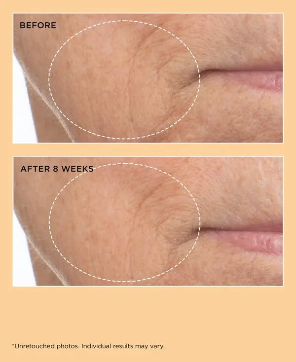 PERRICONE MD Neuropeptide Firming Facial Concentrate