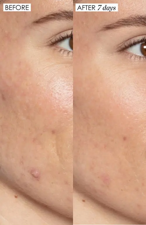 Sunday Riley Auto Correct Eye Cream Duo $130 Value