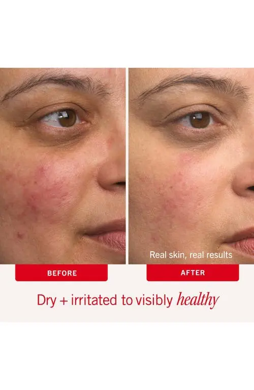FIRST AID BEAUTY Jumbo Ultra Repair Cream For Intense Hydration $77 Value - No Color