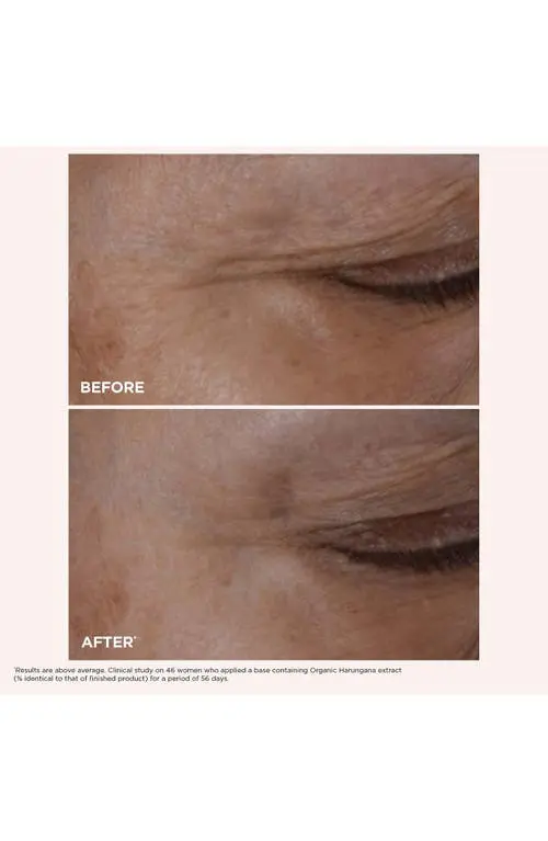 Clarins Total Eye Lift Eye Cream & Refill Set $173 Value