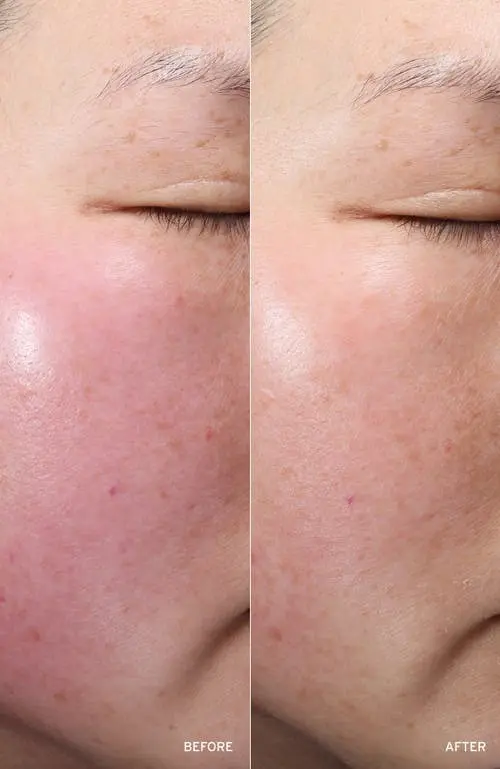 ARAMORE SKINCARE Nad+ Renew & Restore Bundle