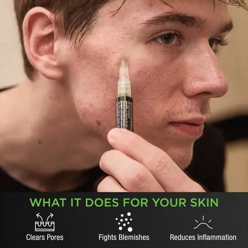 TIEGE HANLEY Acne Gel Pen