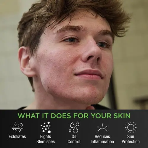 TIEGE HANLEY Level 2 Tiegeclear Acne Advanced Routine