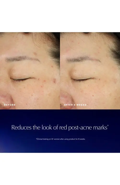 Estée Lauder Advanced Night Repair Recovery Treatment Essence