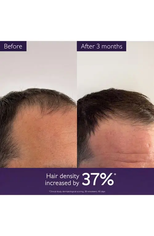 CAUDALIE Hair Density Serum