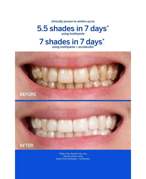SUPERSMILE Org Mint Whitening Kit Professional Whitening Toothpaste With Accelerator, Crystal Collection Toothbrush - No Color