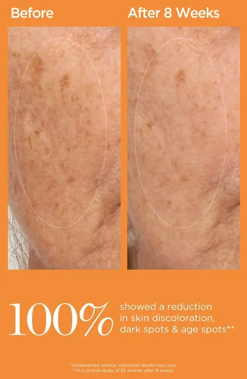 PERRICONE MD Vitamin C Ester 20% Dark Spot Corrective Serum
