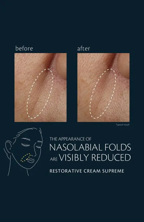 CLE DE PEAU BEAUTE Restorative Cream Supreme - Refill