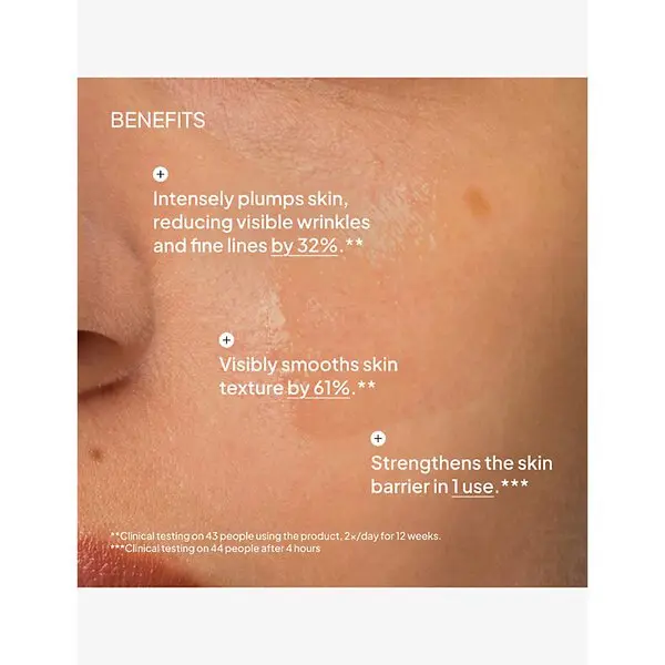 NIOD Multi-molecular Hyaluronic Complex