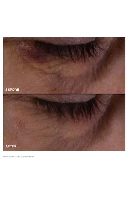 Clarins Double Serum® Eye Depuffing Set $134 Value