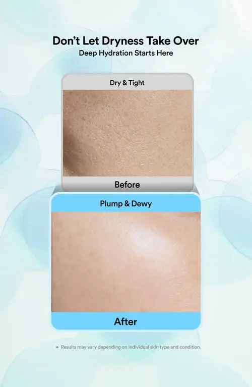SKIT Cica & Azulene Calming Soothing Gel Patch