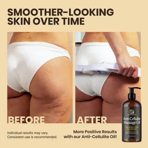 M3 Anti-cellulite Massage Roller