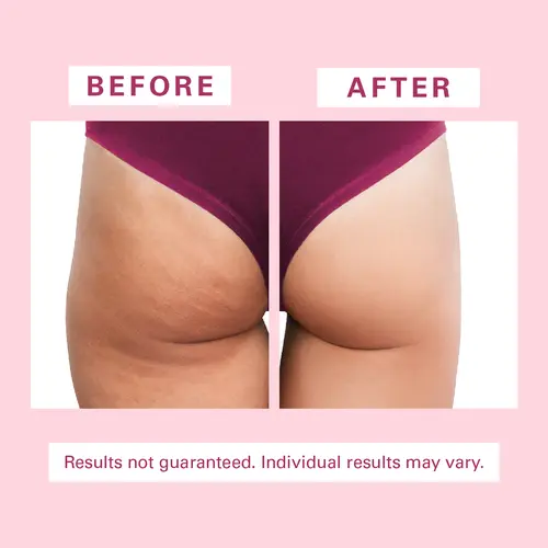 M3 Anti-cellulite Silicone Body Brush