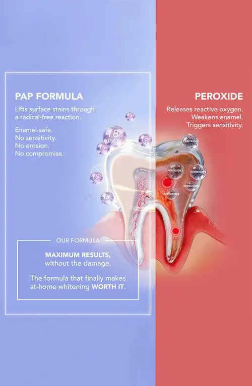 Foreo Issa Led Teeth Whitening Kit