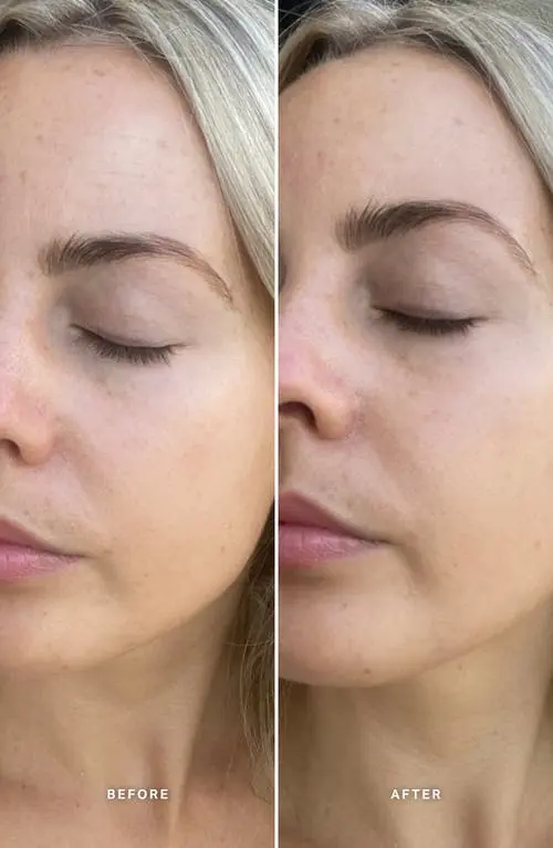 ALPHA-H Vitamin E Serum With 1% Ceramide Complex