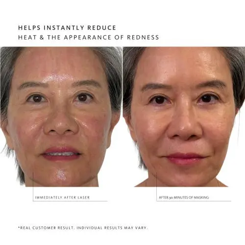 LA LUER Thermoactivated Serum Gel Mask