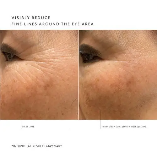 LA LUER Facial Treatment System Pro Device