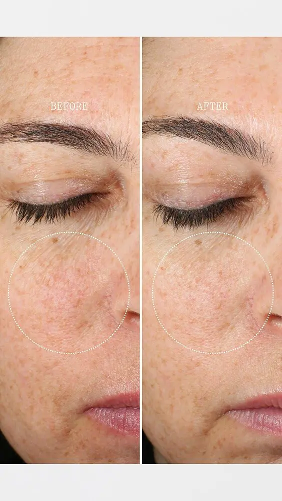 DR. MARNIE Facial Serum