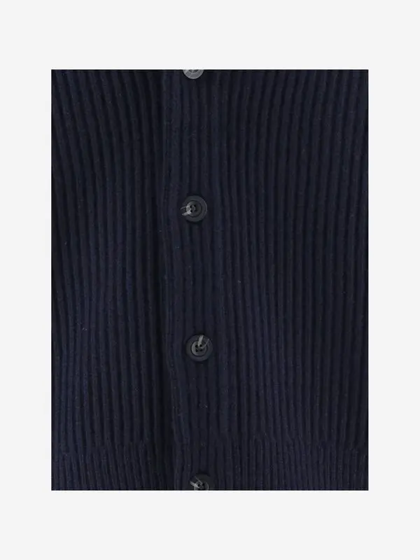 Vince V-neck Button-up Cardigan