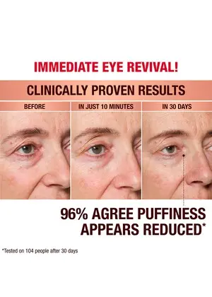 Charlotte Tilbury Immediate Eye Revival Patches, Reduces Puffiness