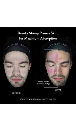 NURSE JAMIE Beauty Stamp Micro-exfoliation Tool