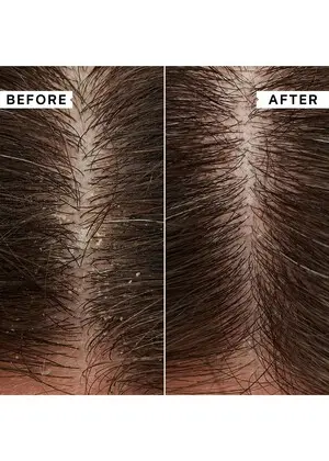 PHILIP KINGSLEY Flaky/itchy Scalp Conditioner