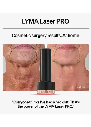 LYMA Laser Starter Kit