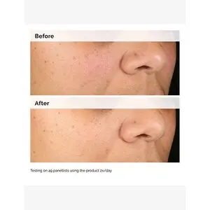 THE ORDINARY Alpha Arbutin 2% + Ha Serum