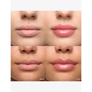 WONDERSKIN Lip Relapse Plumping Gloss - Clear