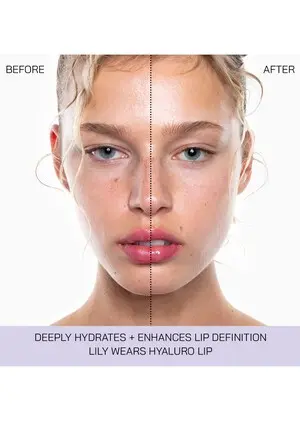ISAMAYA Hyalurolip