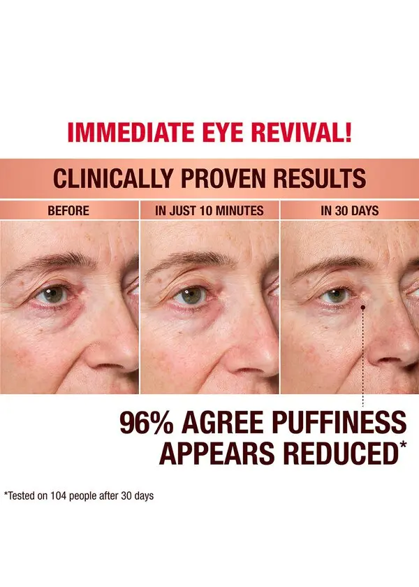 Charlotte Tilbury Immediate Eye Revival Patches, Reduces Puffiness