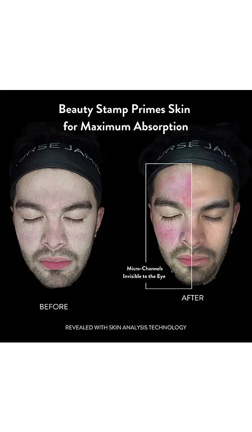 NURSE JAMIE Beauty Stamp Micro-exfoliation Tool