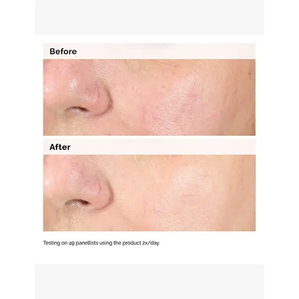 THE ORDINARY Alpha Arbutin 2% + Ha Serum