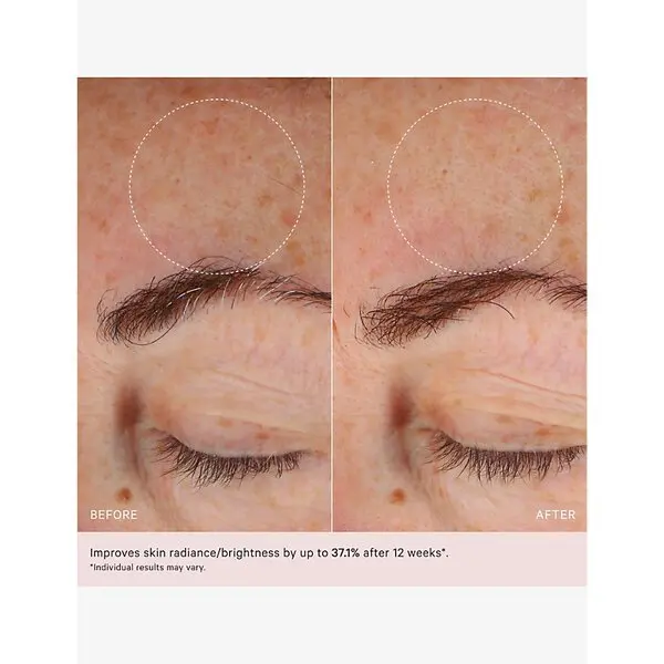 MZ SKIN Micro-peeling Glow Essence