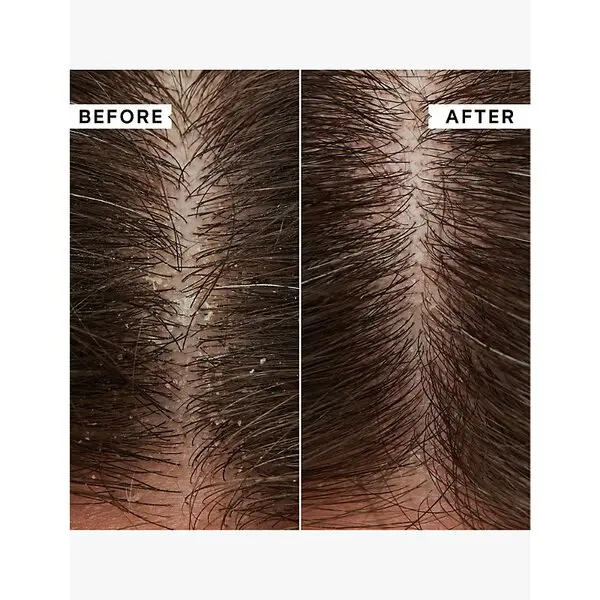 PHILIP KINGSLEY Flaky/itchy Scalp Hydrating Conditioner