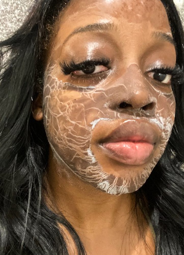 Hanacure All-in-One Face Mask Review: Is it Worth it?